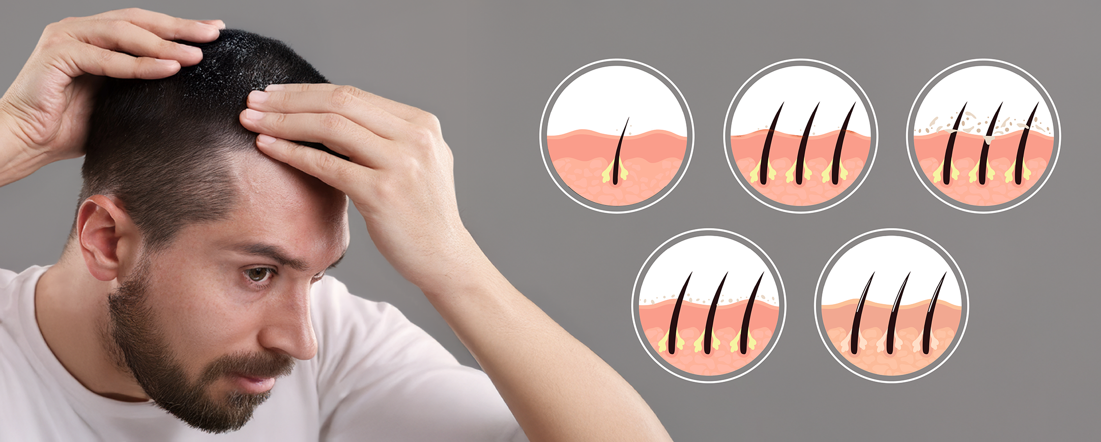 Healthy Hair Starts with the Scalp: Your Guide to Scalp Health – Sebamed UK